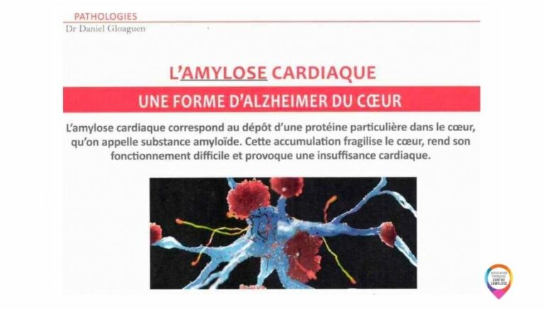 L'Amylose cardiaque, un article du Dr Gloaguen - AFCA